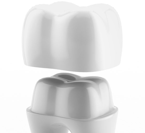 Rapid City CEREC Same-day Crowns - Black Hills Area Dental